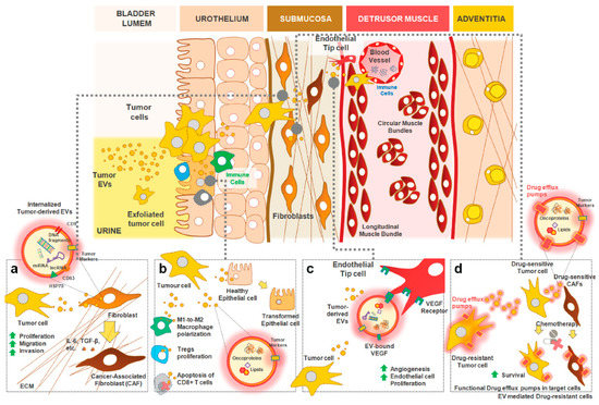 Urinary Biomarkers in Bladder Cancer: Where Do We Stand and Potential ...