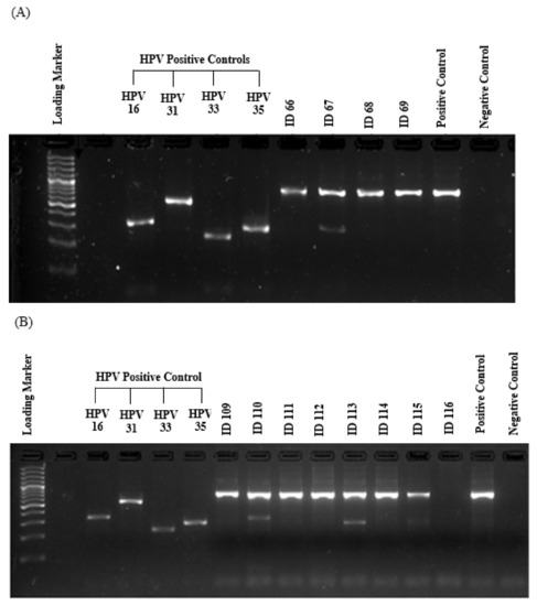 Prevalence and Type Distribution of High-Risk Human Papillomavirus (HPV ...