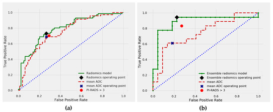 Multiparametric MRI for Prostate Cancer Characterization: Combined Use ...