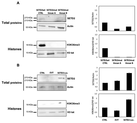 Loss of Function SETD2 Mutations in Poorly Differentiated Metastases ...