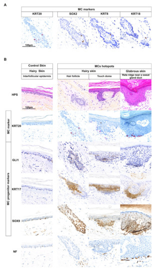 Merkel Cell Polyomavirus T Antigens Induce Merkel Cell-Like ...