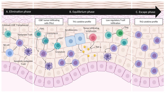 Hypopigmented Mycosis Fungoides: Loss of Pigmentation Reflects ...