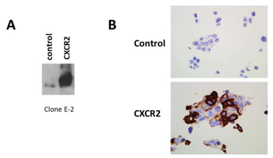 Prognostic Value of CXCR2 in Breast Cancer
