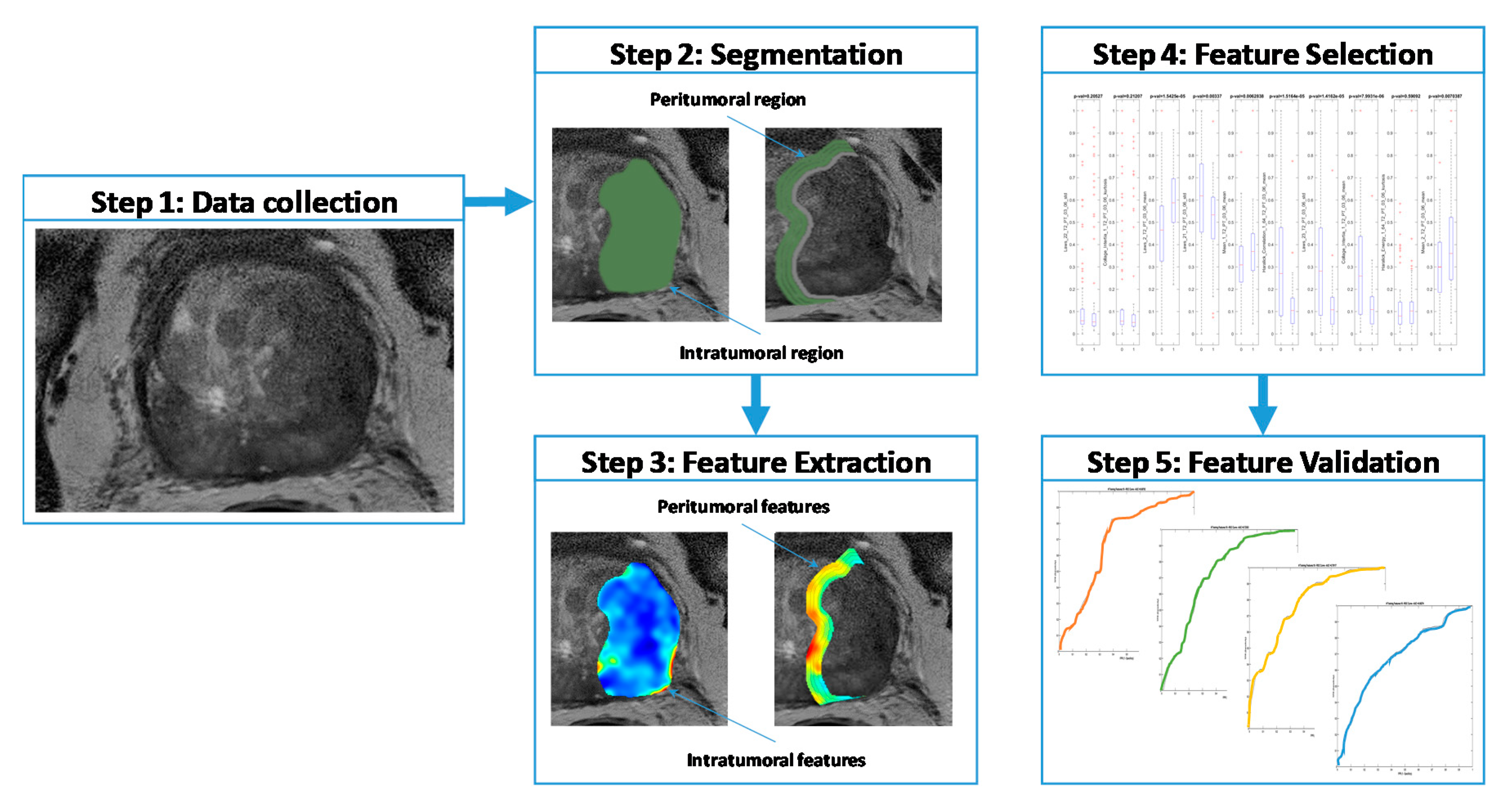 Combination of Peri-Tumoral and Intra-Tumoral Radiomic Features on Bi-Parametric MRI Accurately ...