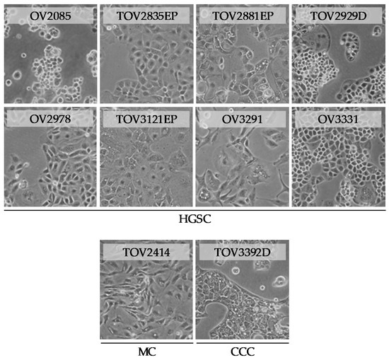 Cancers | Free Full-Text | Modeling the Diversity of Epithelial Ovarian ...