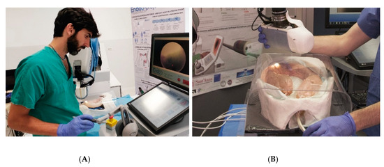 Robotic-Assisted Colonoscopy Platform with a Magnetically-Actuated Soft ...