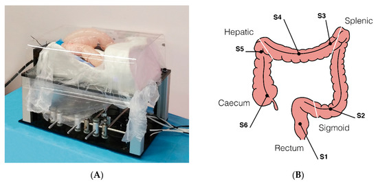 Robotic-Assisted Colonoscopy Platform with a Magnetically-Actuated Soft ...