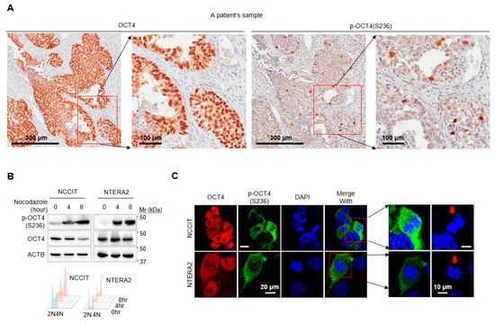 Phosphorylation of OCT4 Serine 236 Inhibits Germ Cell Tumor Growth by ...