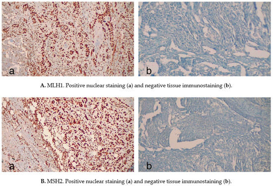 Cancers | Free Full-Text | The Mismatch Repair System (MMR) in Head and ...