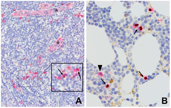 Cancers | Free Full-Text | CD123 as a Biomarker in Hematolymphoid ...