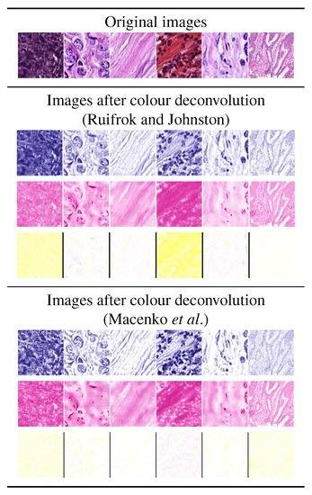 Experimental Assessment of Color Deconvolution and Color Normalization for Automated ...