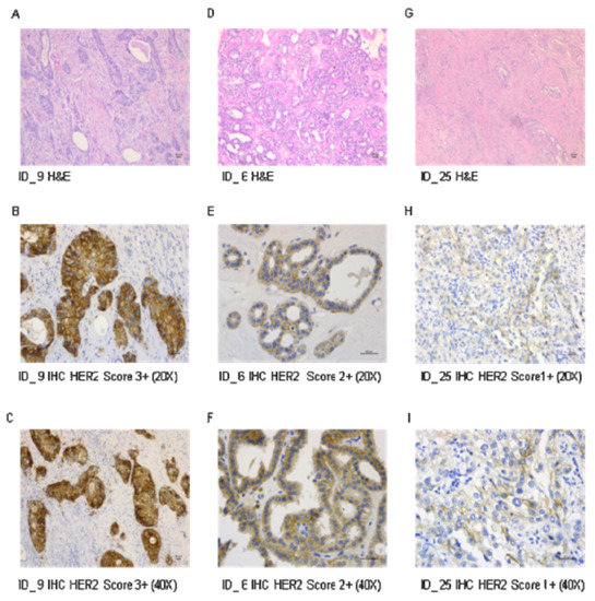 Assessment of HER2 Protein Overexpression and Gene Amplification in ...