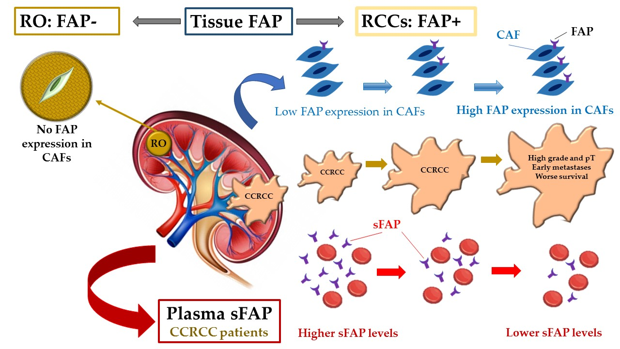 Cancers | Free Full-Text | Altered Tissue and Plasma Levels of ...