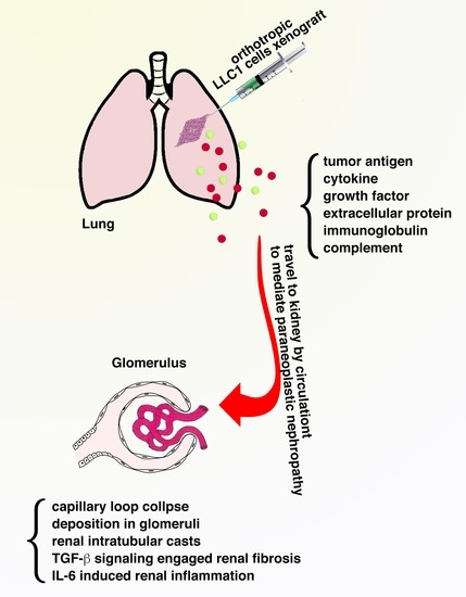 Cancers | Free Full-Text | Lung Cancer Cell-Derived Secretome Mediates ...