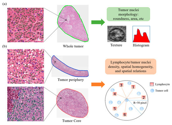 Single-Cell Spatial Analysis of Tumor and Immune Microenvironment on ...