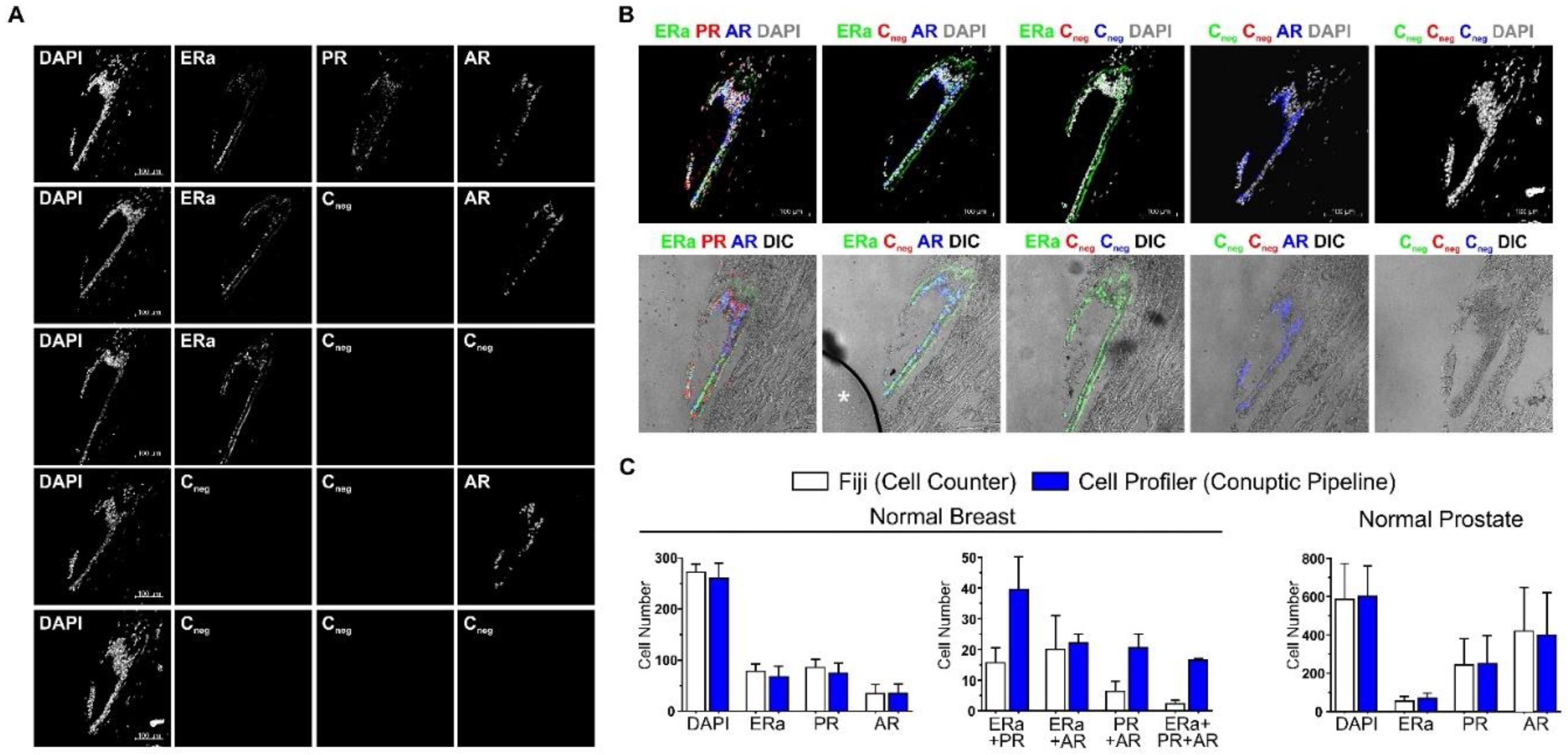 Cancers | Free Full-Text | Sequential Colocalization of ERa, PR, and AR Hormone Receptors Using ...