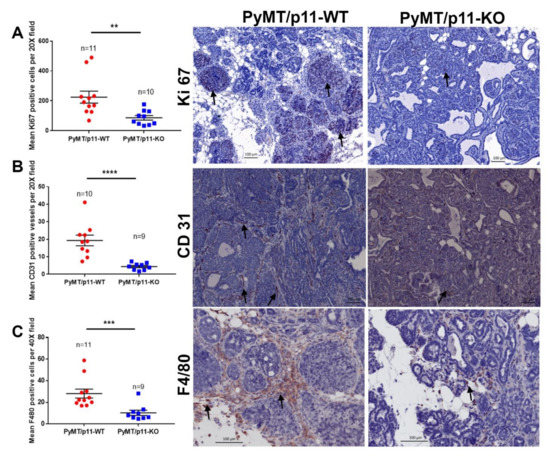 S100A10 Has a Critical Regulatory Function in Mammary Tumor Growth and ...