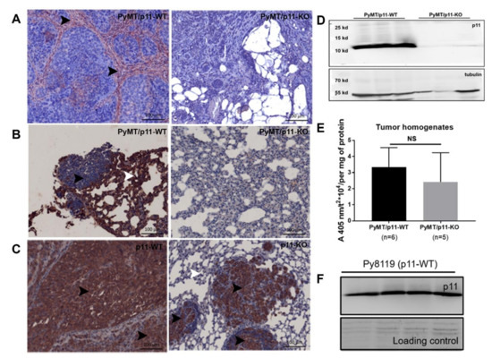 S100A10 Has a Critical Regulatory Function in Mammary Tumor Growth and ...