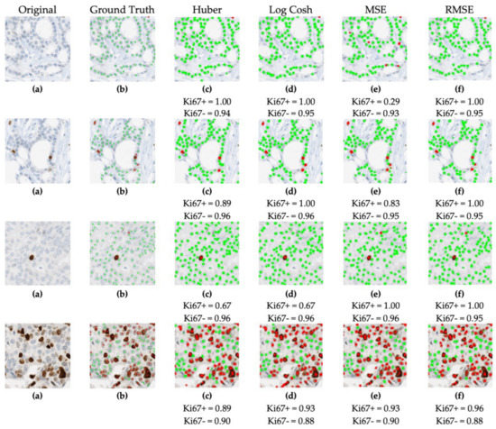 Cancers | Free Full-Text | piNET–An Automated Proliferation Index Calculator Framework for Ki67 ...
