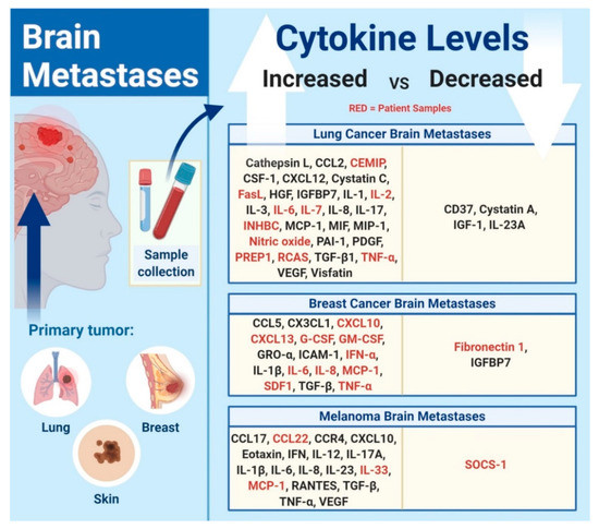 Cancers | Free Full-Text | The Network of Cytokines in Brain Metastases