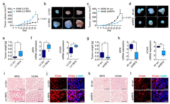 Cancers | Free Full-Text | Interferon Regulatory Factor 9 Promotes Lung ...