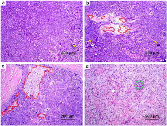 Cancers | Free Full-Text | A Modified 2 Tier Chemotherapy Response ...