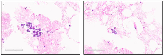 Pathology and Classification of SCLC