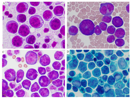 Primary Effusion Lymphoma: A Clinicopathological Study of 70 Cases