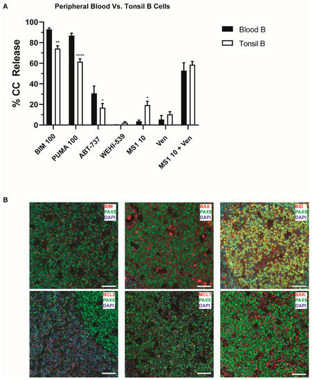 Apoptotic Blocks in Primary Non-Hodgkin B Cell Lymphomas Identified by ...
