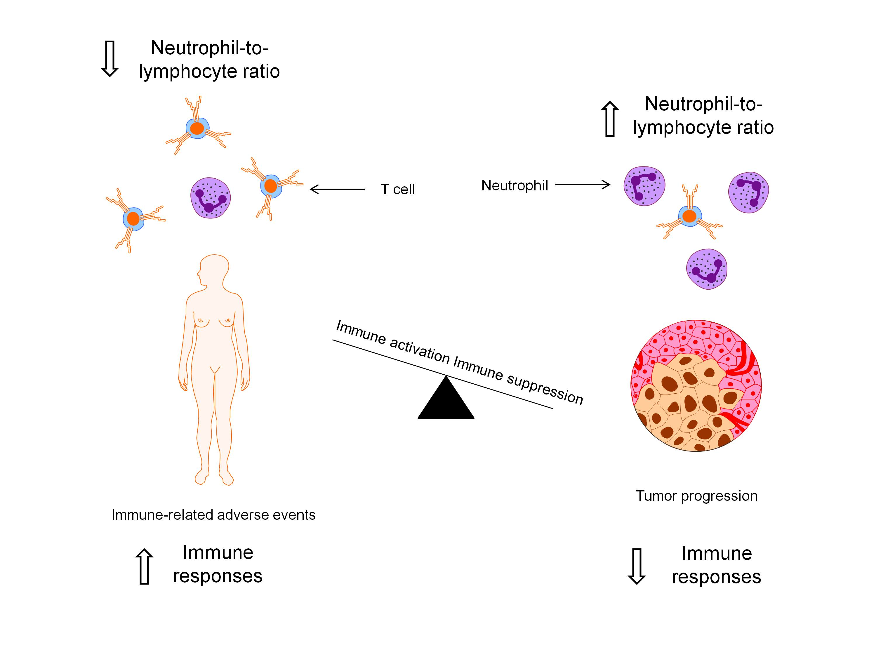Cancers | Free Full-Text | Neutrophil-to-Lymphocyte Ratio Predicts ...
