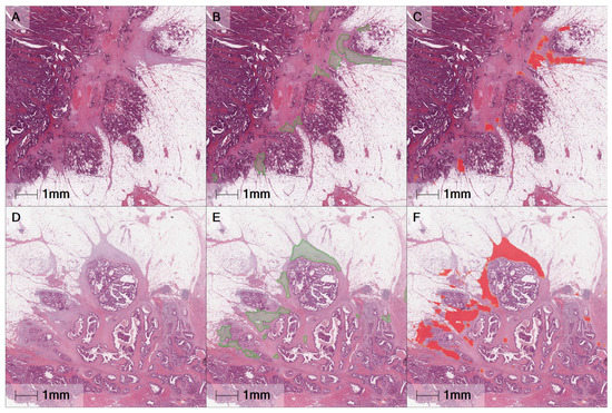 Cancers | Free Full-Text | Automated Detection and Classification of ...