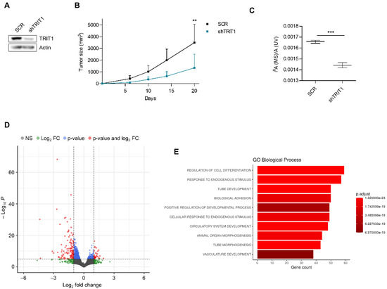 Gene Amplification-Associated Overexpression of the Selenoprotein tRNA ...