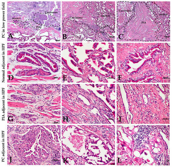 Morphological and Molecular Characterization of Proliferative ...
