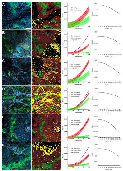 Using the R Package Spatstat to Assess Inhibitory Effects of Microregional Hypoxia on the ...