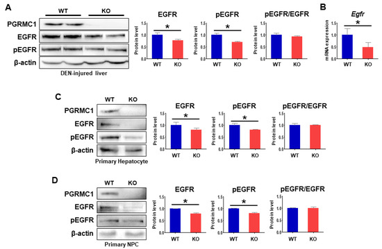 Loss of PGRMC1 Delays the Progression of Hepatocellular Carcinoma via ...