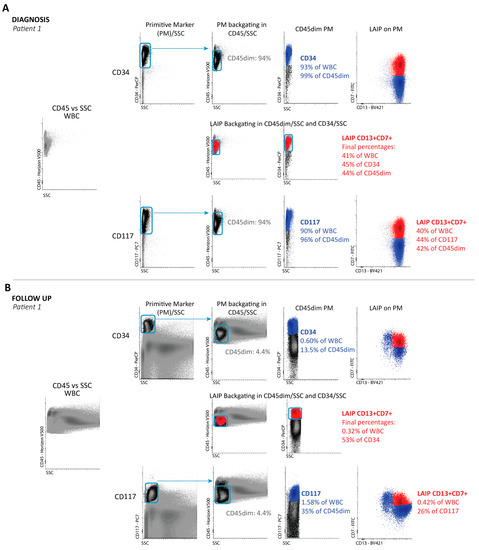 AML/Normal Progenitor Balance Instead of Total Tumor Load (MRD ...