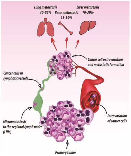 ECM Remodeling in Squamous Cell Carcinoma of the Aerodigestive Tract ...
