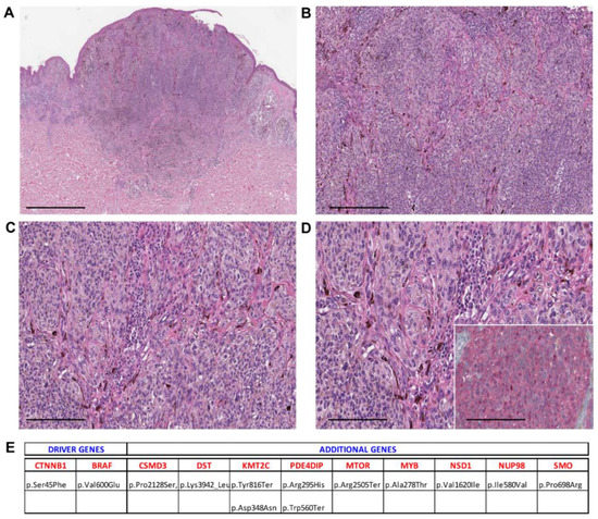 Cancers | Special Issue : Rare Skin Cancers: Recent Advances in ...