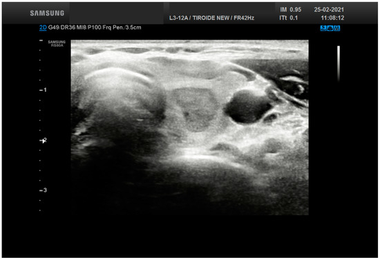 Overview of the Ultrasound Classification Systems in the Field of ...