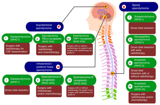 An Insight into Pathophysiological Features and Therapeutic Advances on ...