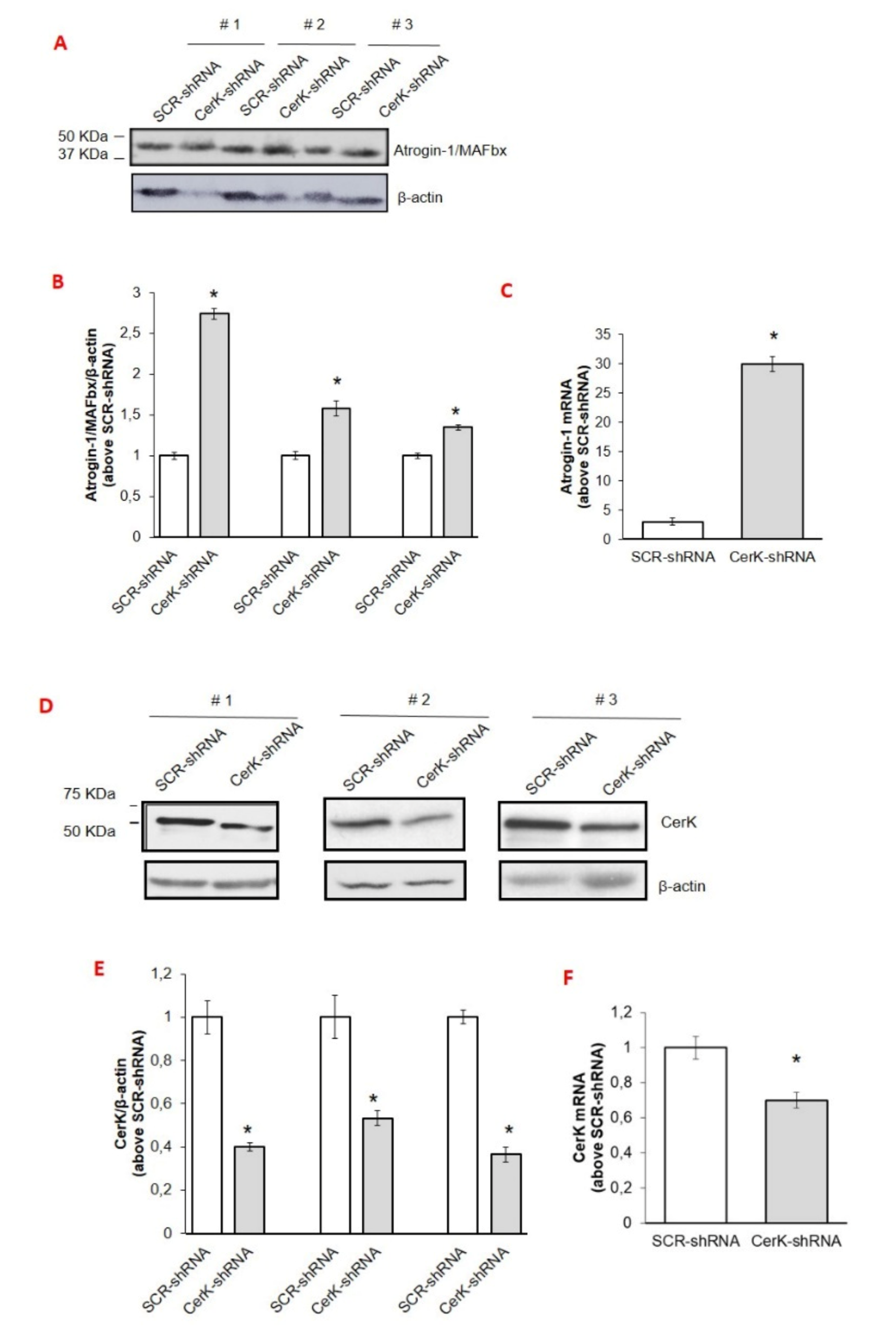 Control of Skeletal Muscle Atrophy Associated to Cancer or ...