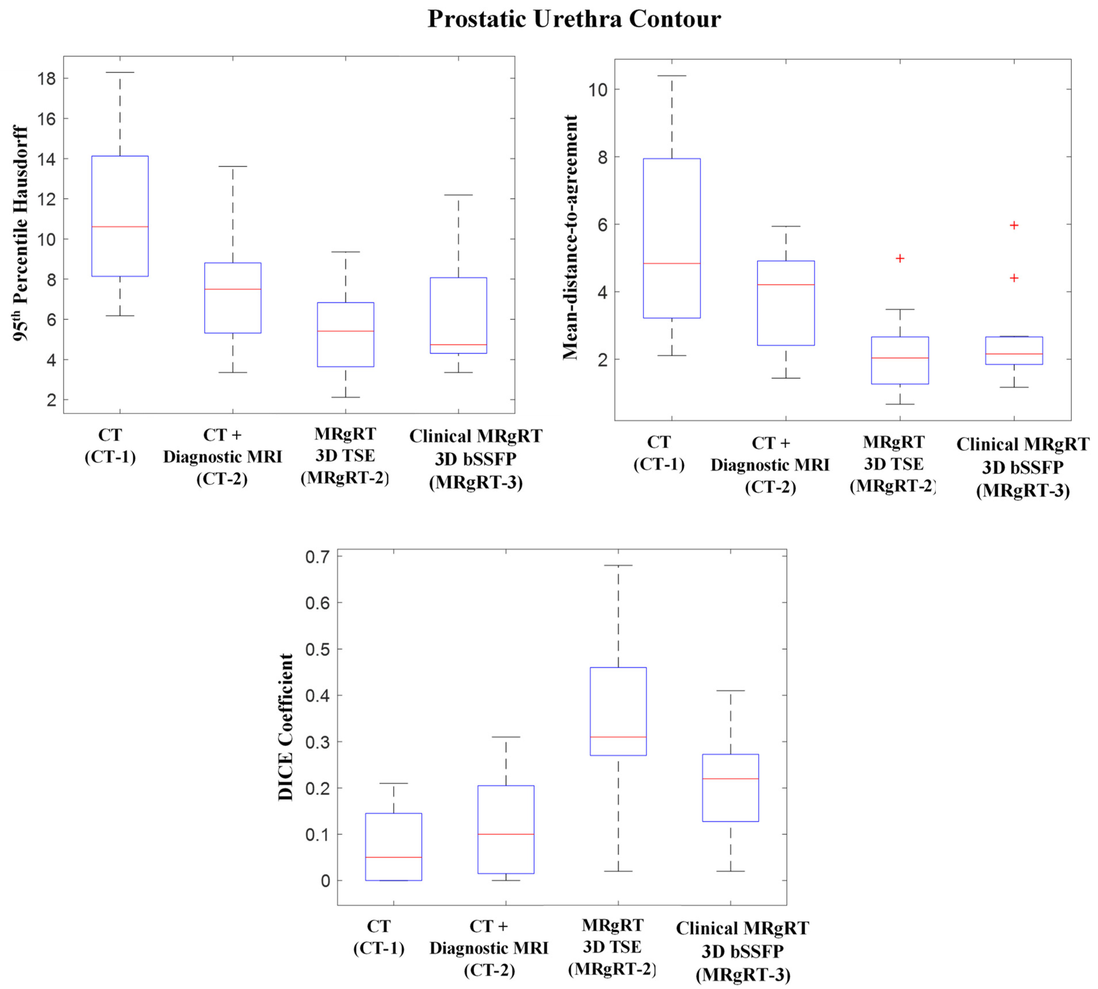 Evaluation of T2-Weighted MRI for Visualization and Sparing of Urethra with MR-Guided Radiation ...