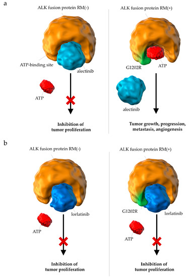 Comparative Efficacy and Safety of Lorlatinib and Alectinib for ALK ...