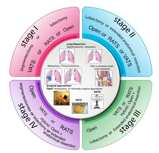 Cancers | Special Issue : The Role of Surgery in Lung Cancer Treatment ...