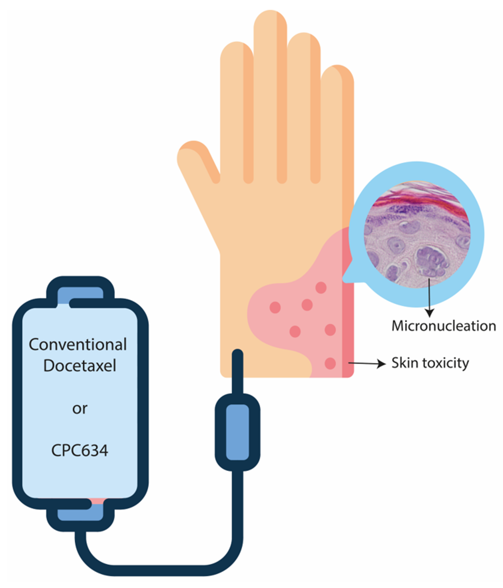 Cancers | Free Full-Text | Docetaxel Skin Exposure and Micronucleation ...