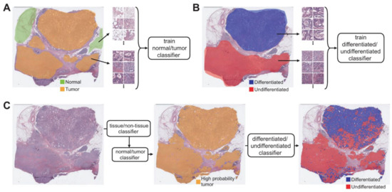 Deep Learning for Automatic Subclassification of Gastric Carcinoma ...