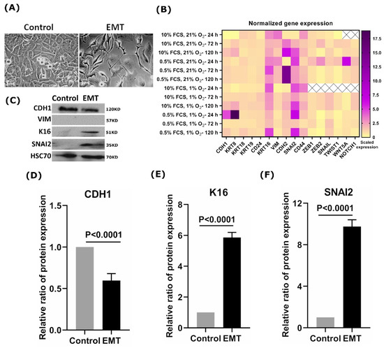 Emerging Insights into Keratin 16 Expression during Metastatic ...