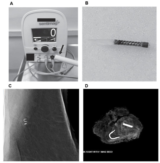 Options to Determine Pathological Response of Axillary Lymph Node ...