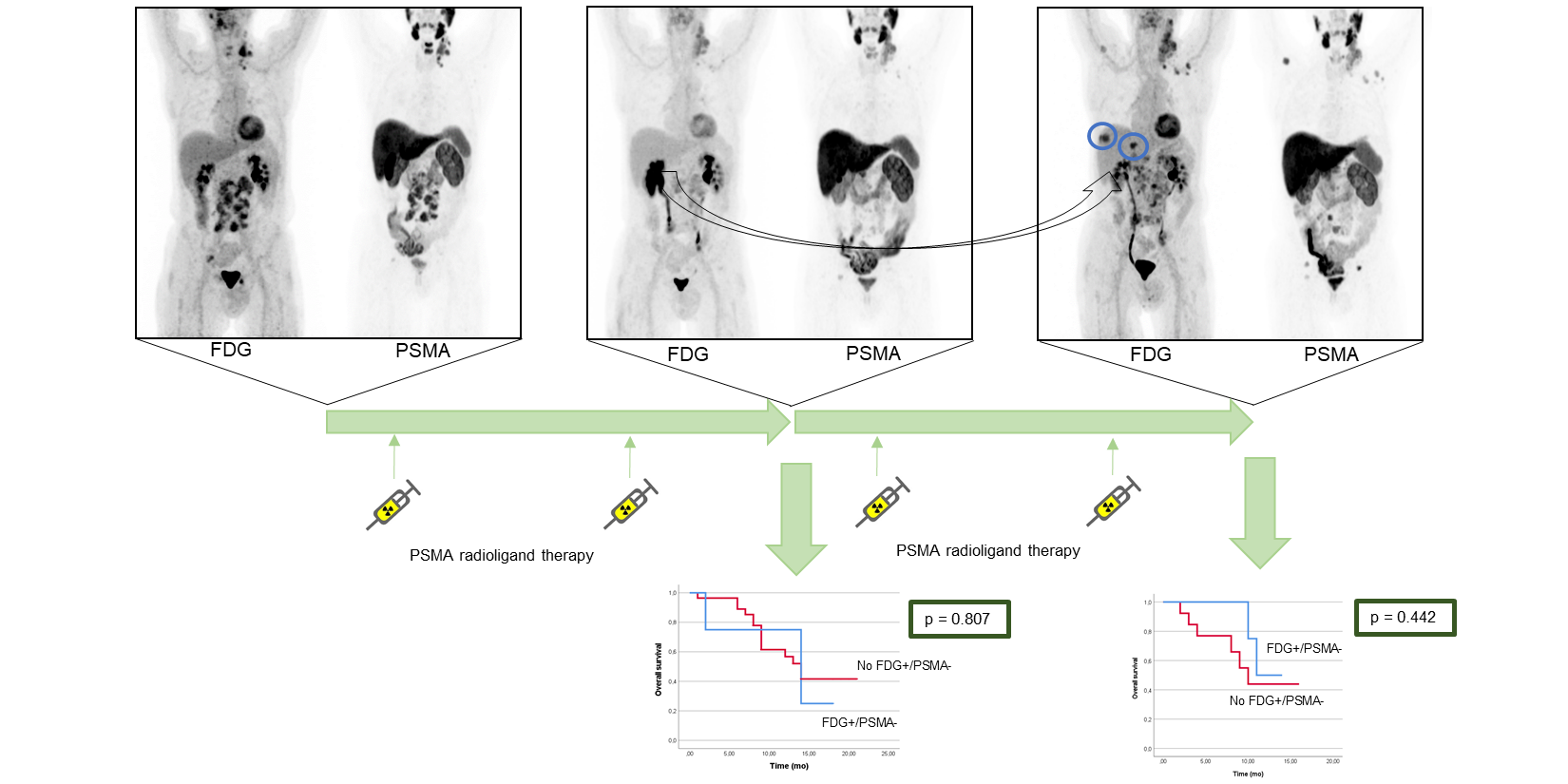 Cancers | Free Full-Text | Development of Discordant Hypermetabolic ...