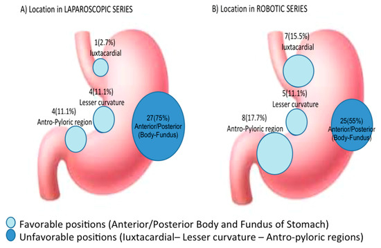 Minimally Invasive Approach to Gastric GISTs: Analysis of a Multicenter ...